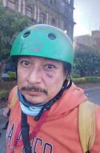 Police attack photojournalist; It was collateral damage: Pablo Vázquez ...